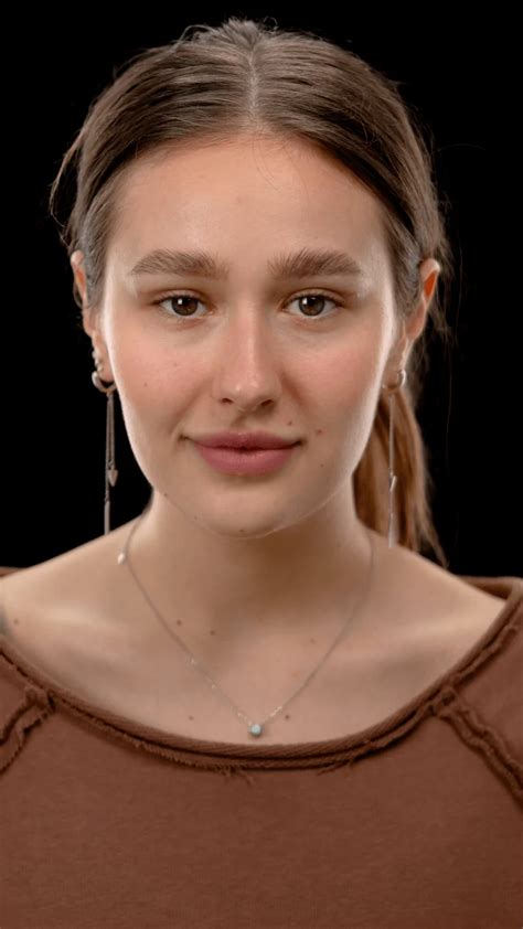 Темпоральний ліфтинг Пластична хірургія Yurchenko Team