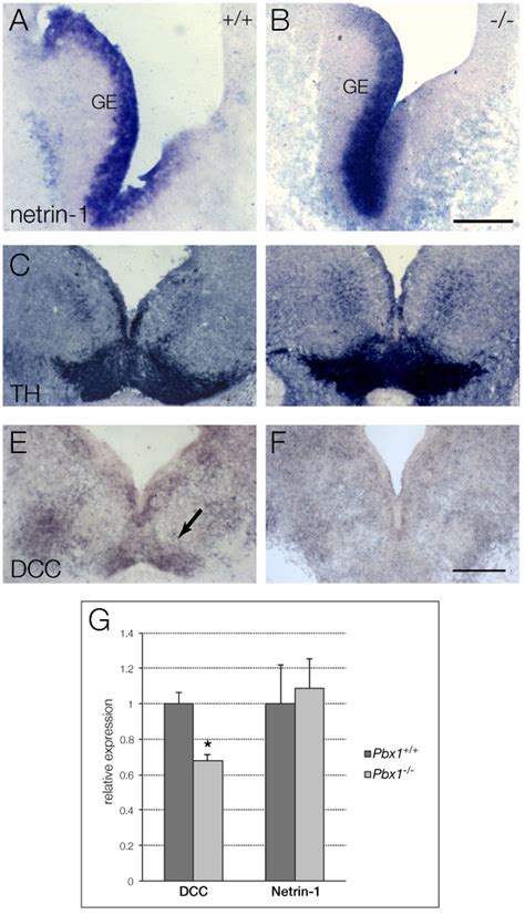 Netrin 1 And Dcc Expression In Pbx1 Null And Wild Type Embryos In Situ Download Scientific