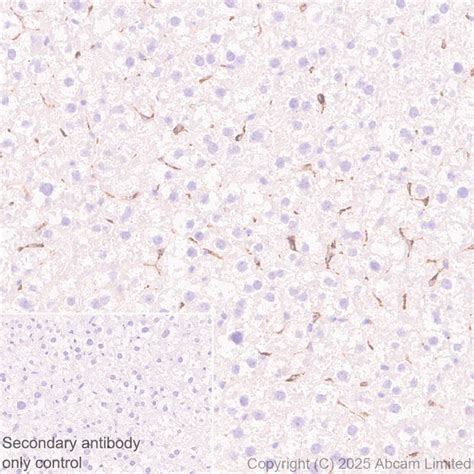 Anti Cd5lct 2 Antibody Epr29364 21 Ab324193 Abcam