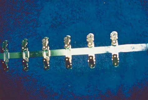 Radiography Intra Oral Parallel And Bisecting Angle Vetcetera