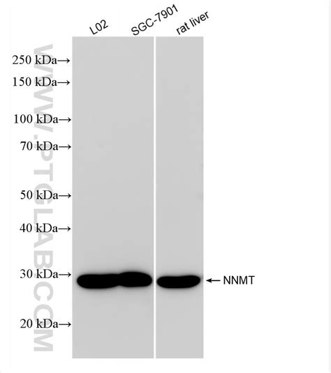 Nnmt Antibody 84876 5 Rr Proteintech