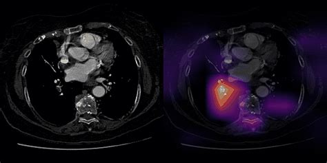 Penet—a Scalable Deep Learning Model For Automated Diagnosis Of Pulmonary Embolism Using