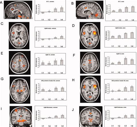 Sex Differences In Brain Activation To Anticipated And Experienced Pain In The Medial Prefrontal