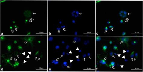 A F Organization Of Vimentin In A549 Cells After Treatment With