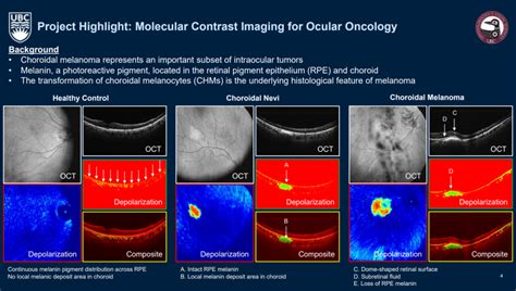 Computational Opthalmic Imaging Lab Coil Slide 4