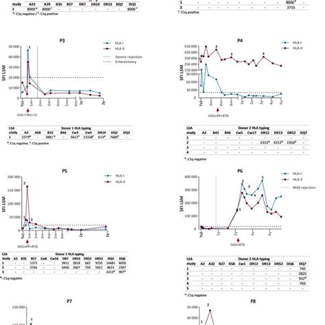 Evolution Of Anti Hla Antibodies Levels Sfi And Dsa Mfi In The Eight