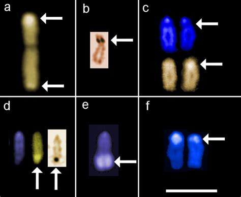 Polymorphic Location Of Agnor Gc And At Rich Regions On Investigated Download Scientific