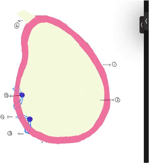 The Procedure Depicted Figuratively 1 Labrum 2 Glenoid 3 Mattress