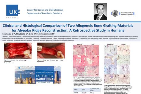 Posterosteology2019 Clinical And Histological Comparison Of Two