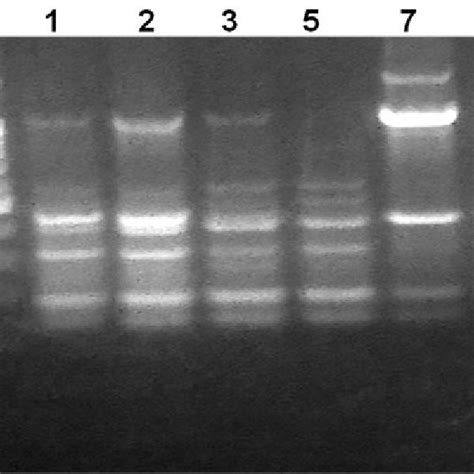 Pdf Isolation Identification And Rapd Pcr Analysis Of New Isolated Bacillus Thuringensis