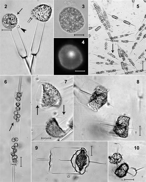 Life Cycle Stages In Ditylum Brightwellii Fig 2 Live Egg Arrow And