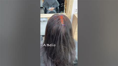 숱없고 가르마가 너무 벌어져 휑해 보이는 머리 뿌리볼륨 모류교정 링거펌으로 풍성하게 보완해드렸어요hair 링거펌모류교정