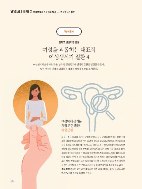 When여성을 괴롭히는 대표적 여성생식기 질환 4건강보험 2020년 02월호