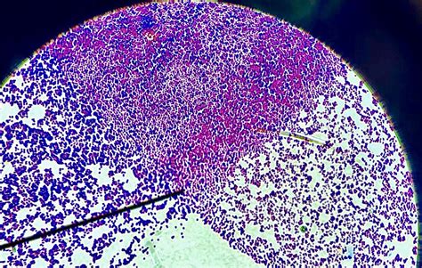 Micro Lab 5 Straphylococcus Epidermidis And Neisseria Perflava Diagram