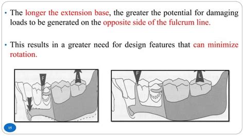 Rpi And Rpa System Pptx Dental Health Diseases And Conditions