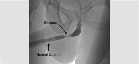 Racgp Ajgp Australian Journal Of General Practice