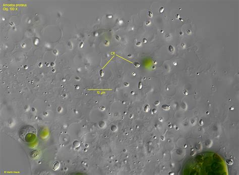 Amoeba Proteus Real Micro Life