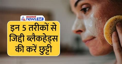 खूबसूरती को बिगाड़ रहा है ब्लैकहेड्स तो इन 5 आसान तरीकों से जड़ से