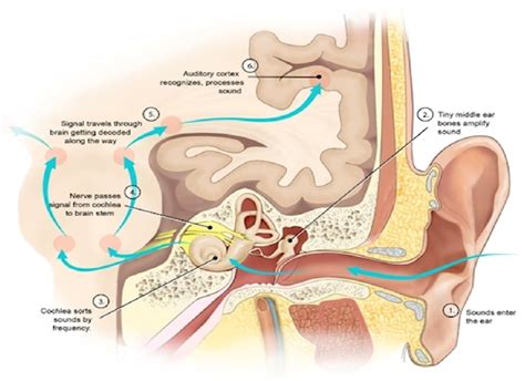 Auditory Processing System Accessed At Download Scientific Diagram