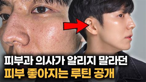 혼자만 알고싶은 피부 관리 치트키 공개합니다 집에서 쉽게 모공 줄이는 방법 Youtube