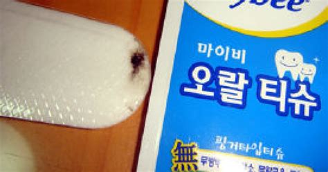 아기 구강 티슈에 곰팡이가