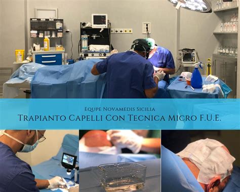 Medites Trapianto Capelli Sicilia