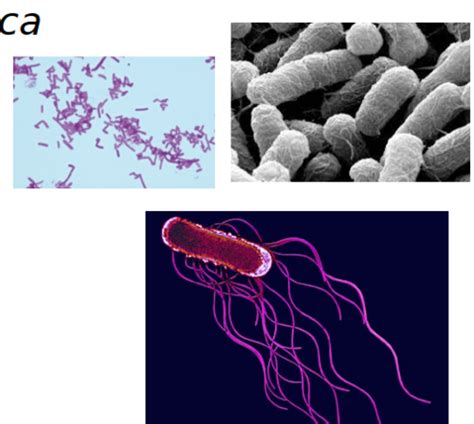 Lab 5 Microbiology Lab Series Flashcards Quizlet
