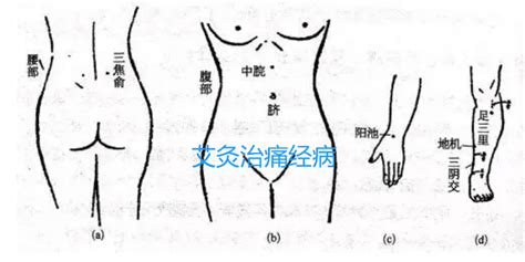 艾灸方法技巧 艾灸百科