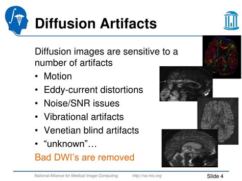 Ppt Diffusion Imaging Quality Control With Dtiprep Powerpoint