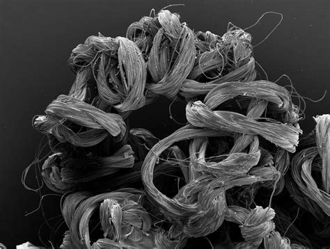 Tissue Samples Alexandra Knie