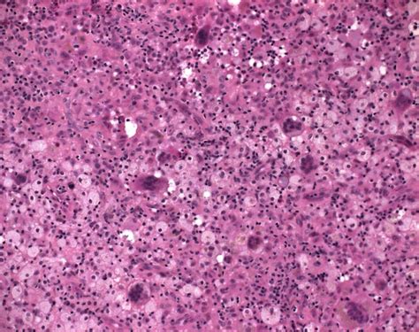 Langerhans Cells Histology