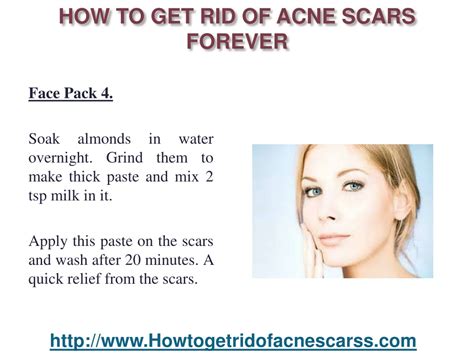 Ppt How To Get Rid Of Acne Scars Forever Powerpoint Presentation Free Download Id