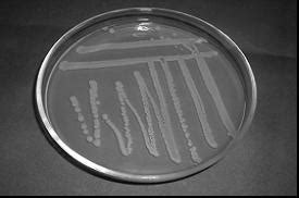 Large Rough Colonies Of Bacillus Spp E Hrs With Whip Like Download Scientific Diagram