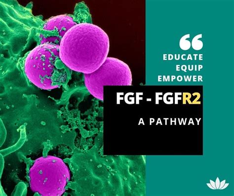 Cholangiocarcinoma And Fgfr2 Cholangiocarcinoma Australia