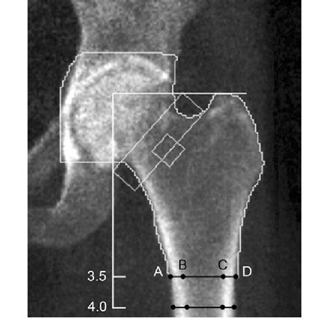 A DXA Scan That Was Uploaded To A PACS Is Shown Measurements Were Download Scientific Diagram