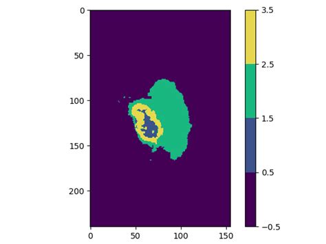 Image Segmentation Train A U Net Model To Segment Brain Tumors Ovhcloud Blog