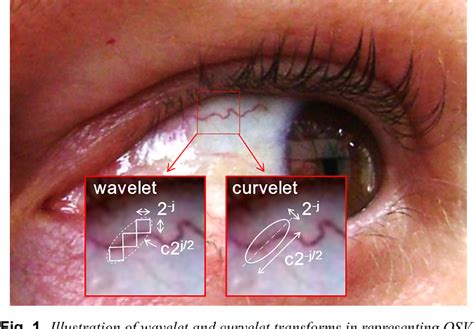 Figure 1 From Ocular Surface Vasculature Recognition Using Curvelet