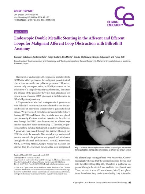 Pdf Endoscopic Double Metallic Stenting In The Afferent And Efferent Loops For Malignant