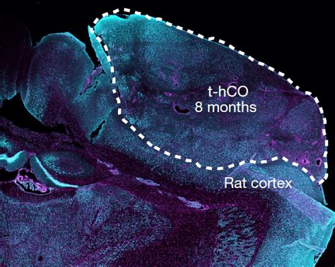 Researchers Develop Method To Study Brain Connectivity Functionality Resource Center