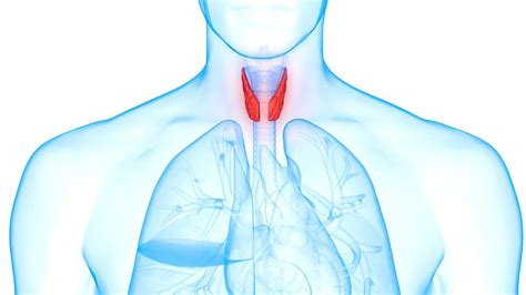 Pierre Louis Malphettes On Linkedin Subakute Thyreoiditis De Quervain