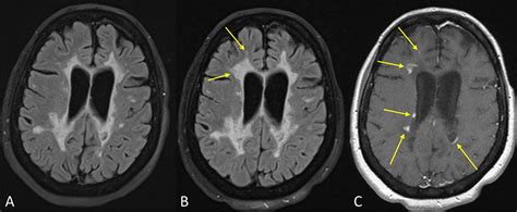 Radiographic And Magnetic Resonance Imaging Identification Advances In