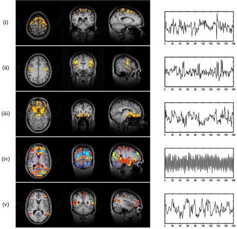 Ensuring Meaningful Fmri Data Applysci Deep Tech Health Neurotech