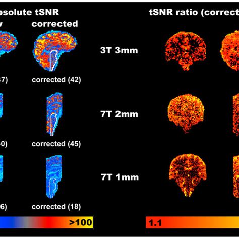 Representative Improvements In Temporal Signal To Noise Tsnr Obtained