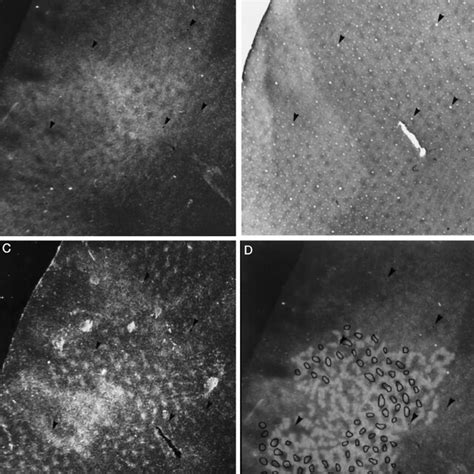 A Section From The Peripheral Left Striate Cortex Of Monkey 1 Through Download Scientific
