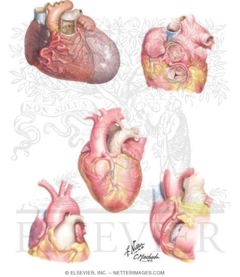 Coronary Arteries Netter