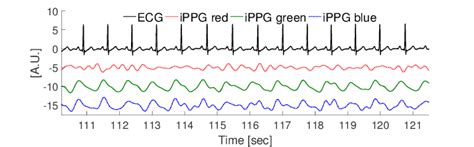 An Example Of The Rgb Ippg Waveforms The Ecg Is Displayed On Top As
