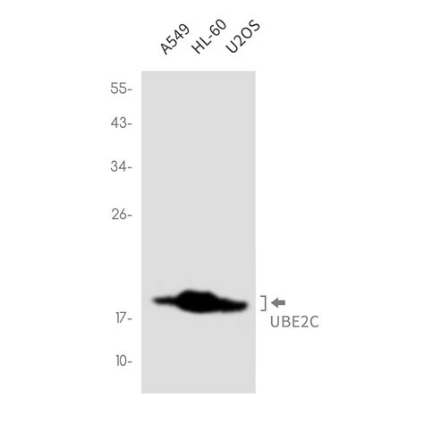 Ubiquitin Conjugating Enzyme E2 C Rabbit Mab Wb Ihc P Ihc F Ip