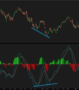 MACD Indicator For ThinkOrSwim A Complete Breakdown