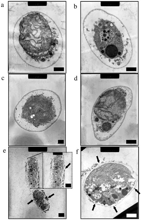 Cross Sectioned Transmission Electron Microscopy Tem Images A B