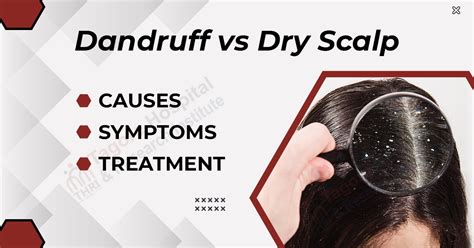 Dandruff Vs Dry Scalp Dandruff Vs Dry Scalp